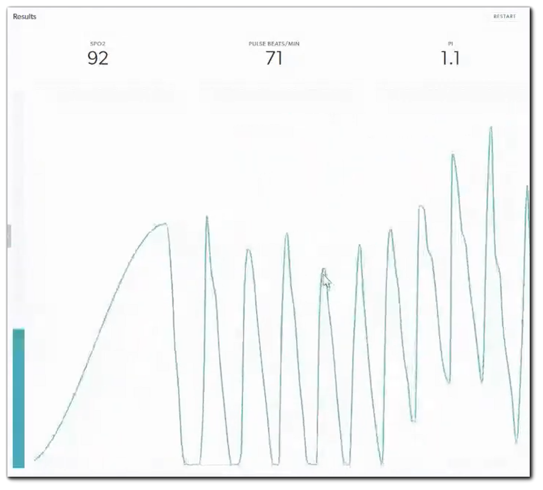 How to Install and Use the Pulse Oximeter Remote Monitoring App
